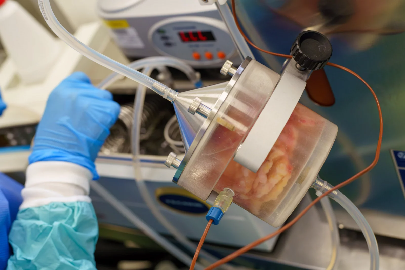 Transplantace Langerhansových ostrůvků nahrazuje slinivku, separátor ...