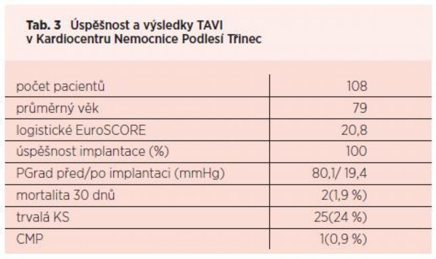 Léčba onemocnění aortální chlopně - Zdraví.euro.cz