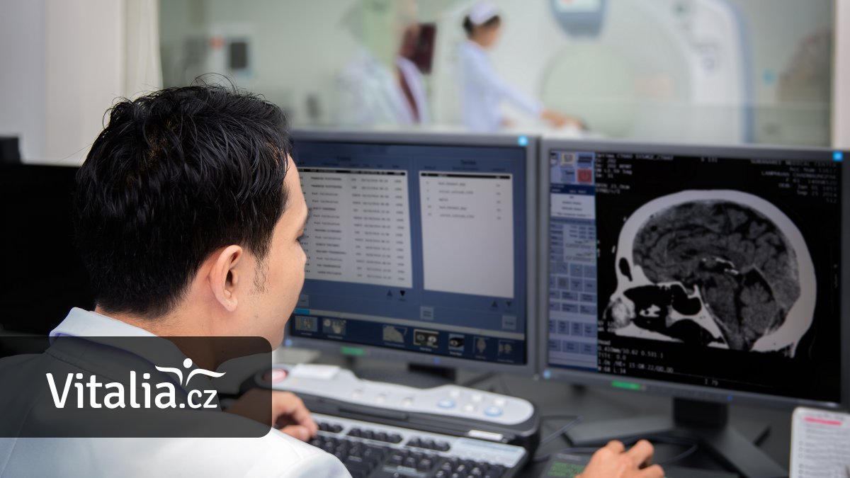 VZP uhradí některým pacientům léčbu rakoviny mozku metodou TTF Optune ...