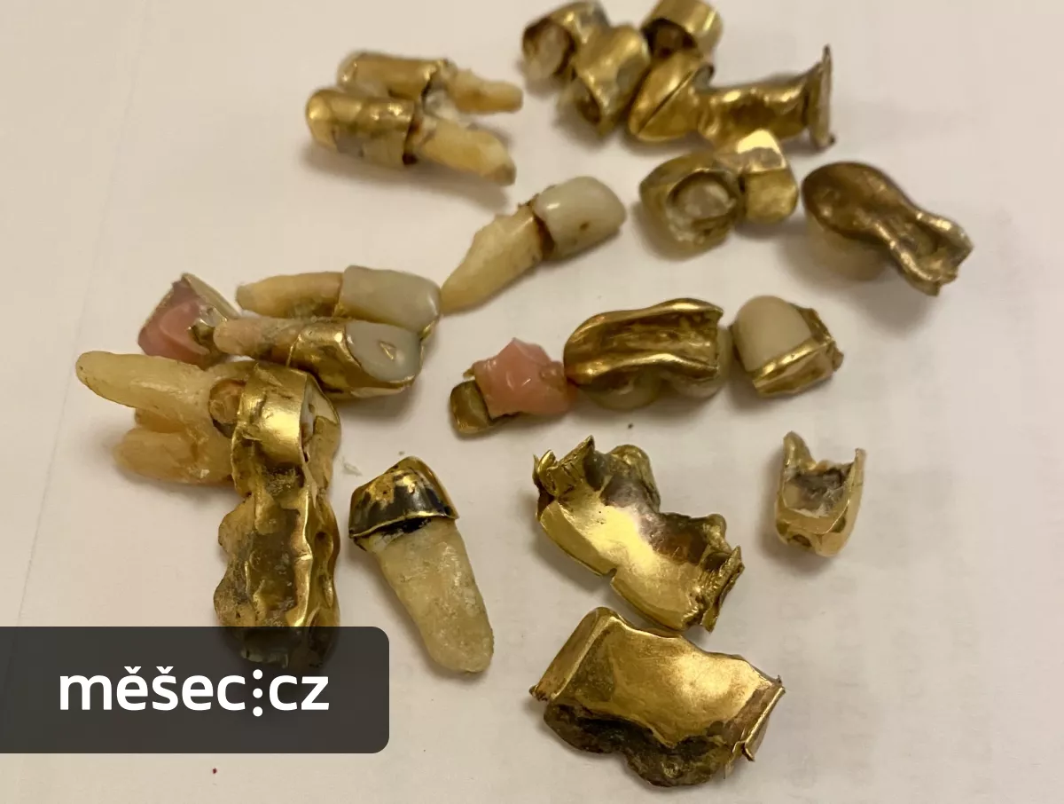 Máte doma zlaté zuby po předcích? Poradíme vám, jak je zpeněžit - Měšec.cz