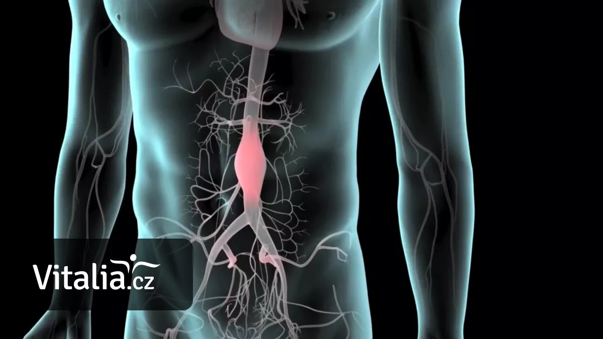 Začal nový screening výdutě aorty. Může vás na něj poslat praktik ...